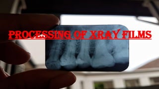 PROCESSING OF XRAY FILM, THE STEPS UNDER THE PROCEDURE | PPTX