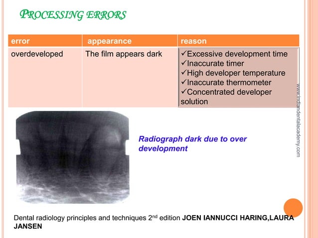 Processing x rays /endodontic courses | PPT