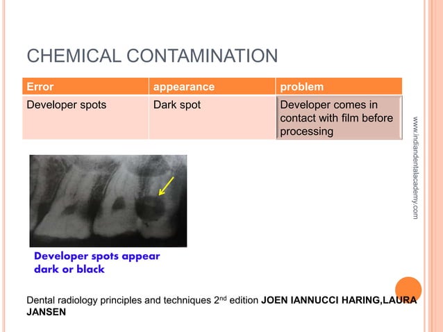 Processing x rays /endodontic courses | PPT