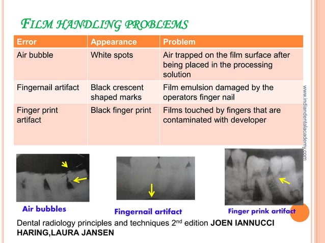 Processing x rays /endodontic courses | PPT