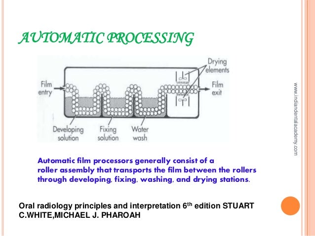 Processing x rays /endodontic courses