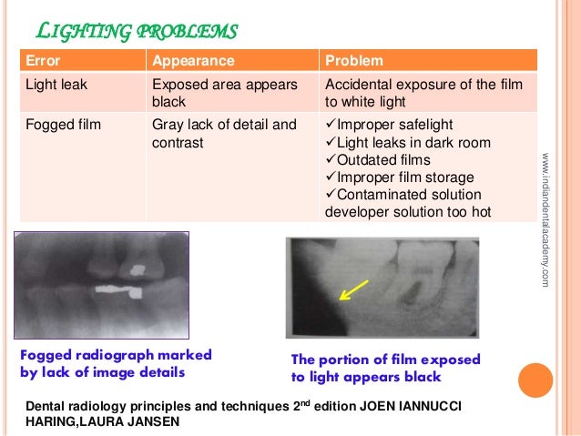 Processing x rays /endodontic courses