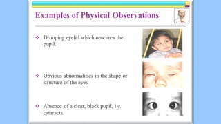 Process of seeing pdf | PDF