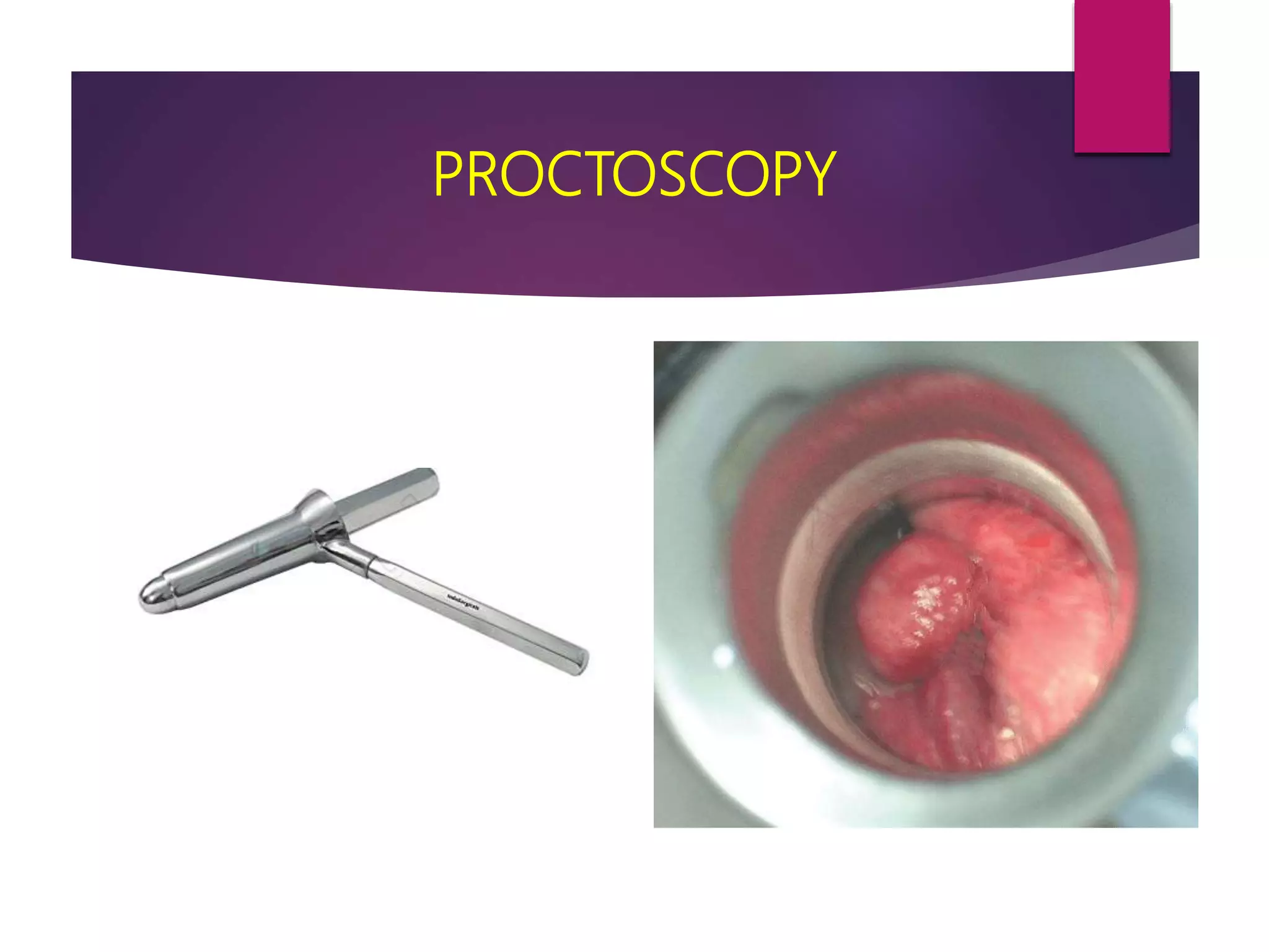 Laser Surgery in Proctology.pptx