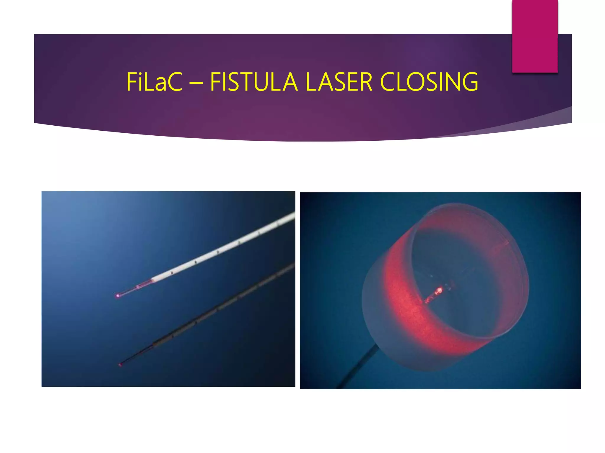 Laser Surgery in Proctology.pptx