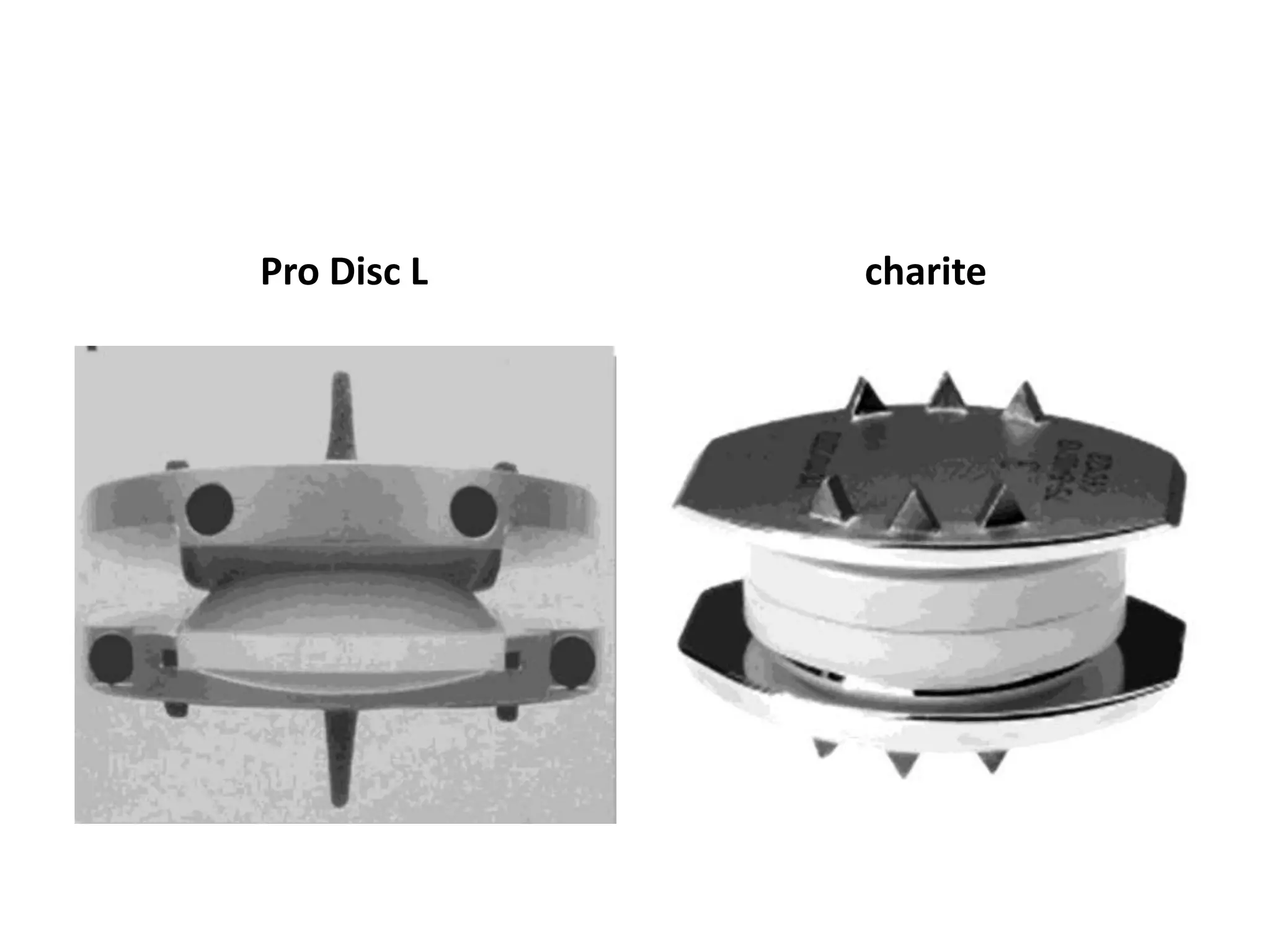 Pro disc l replacement vs circumferential arthrodesis of spine | PPT
