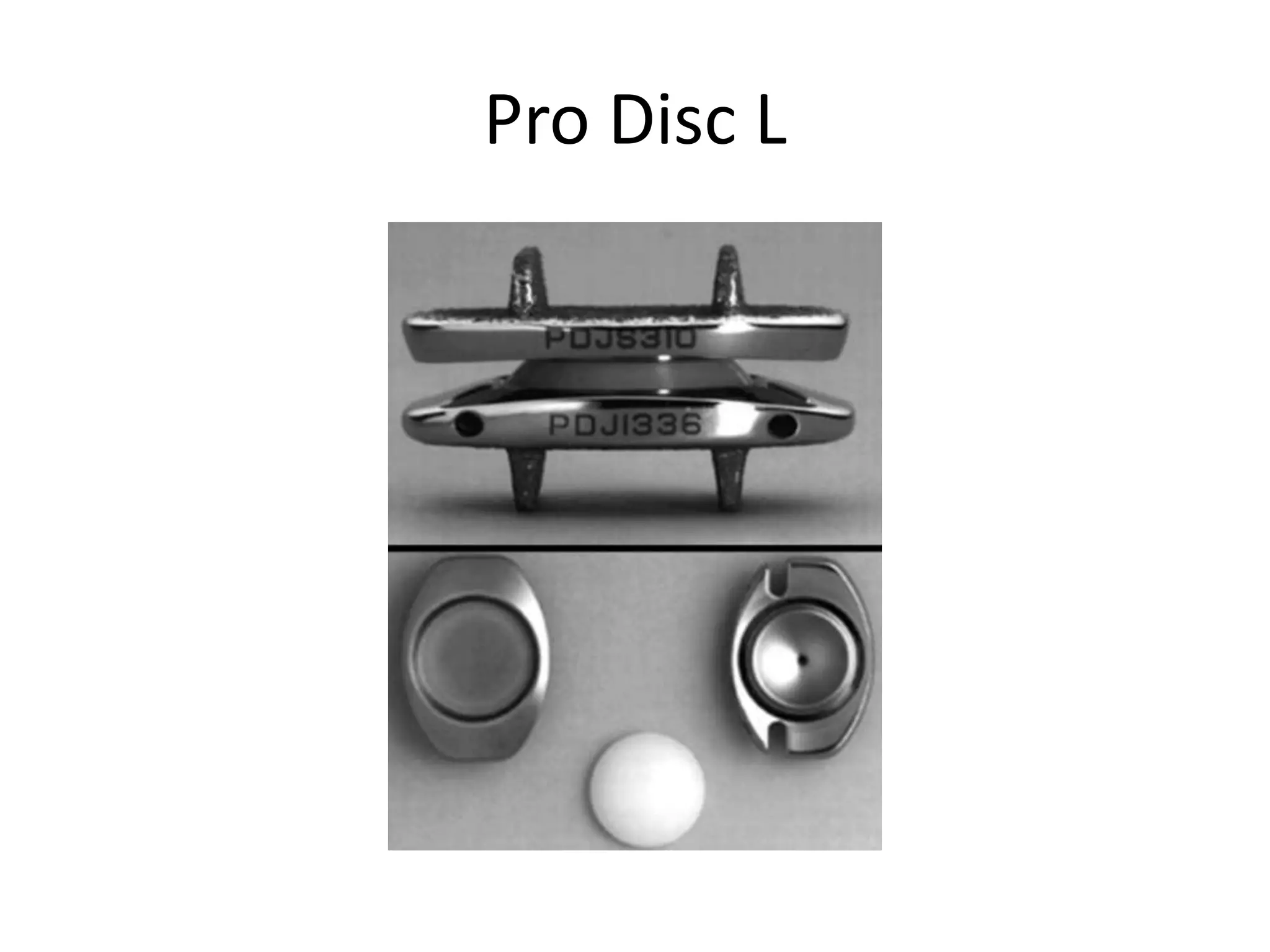 Pro disc l replacement vs circumferential arthrodesis of spine | PPT