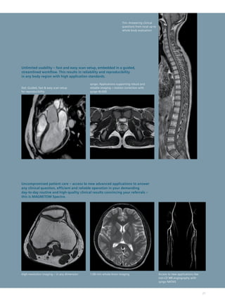 Magnetom Spectra RM 3T -SIEMENS | PDF