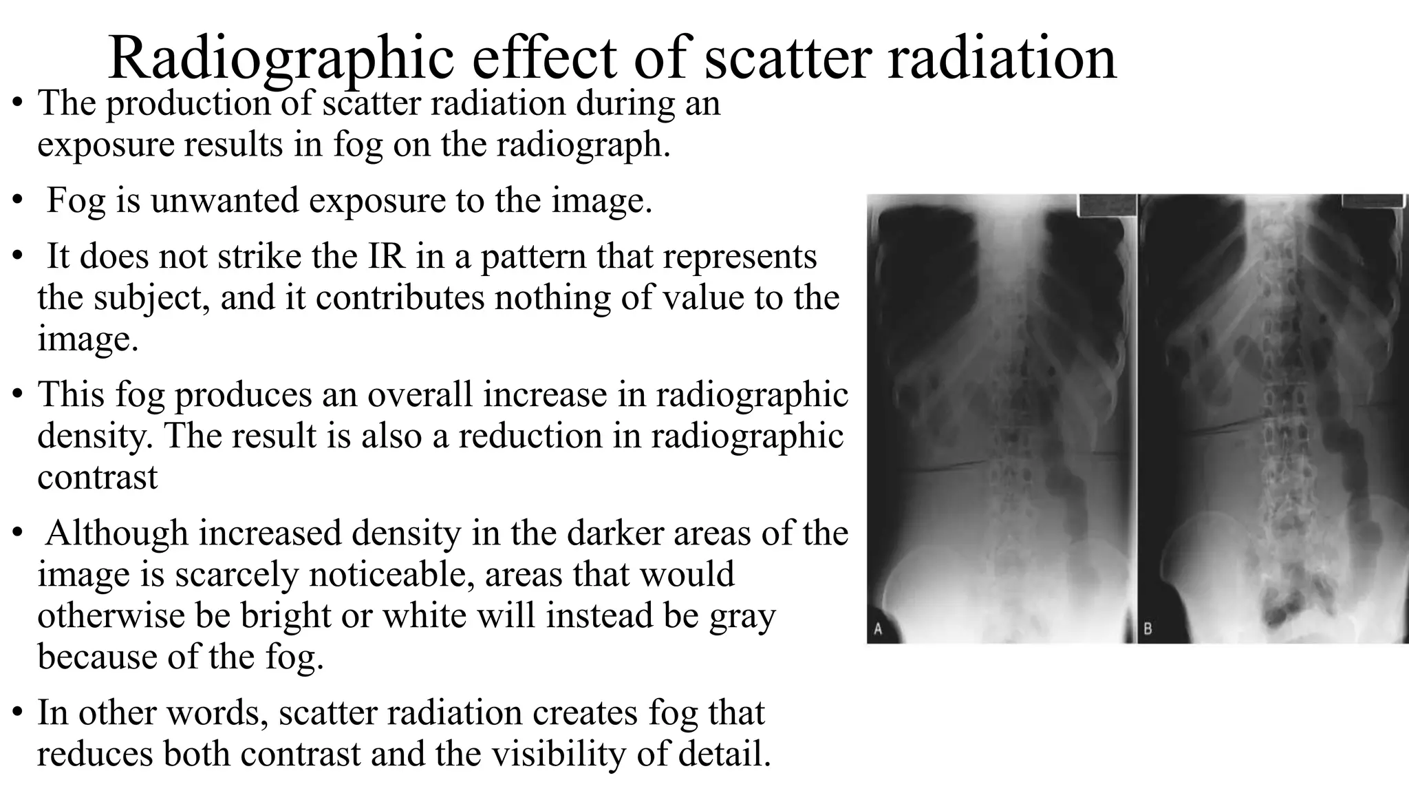 Production and control of scatter radiation (beam | PPTX