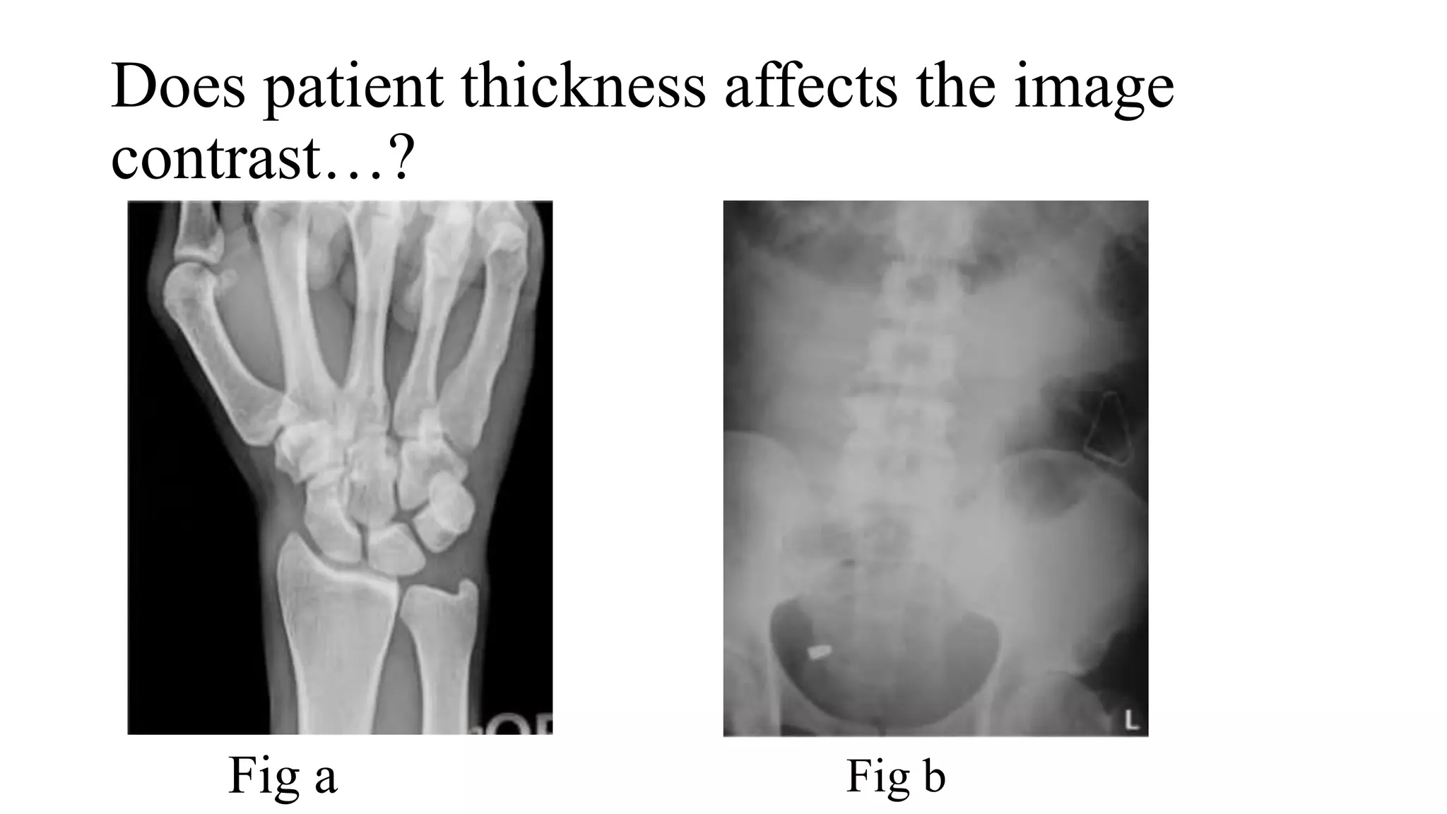 Production and control of scatter radiation (beam | PPTX