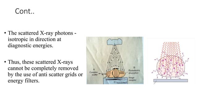 Production and control of scatter radiation (beam | PPTX
