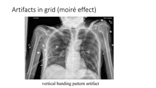 Production and control of scatter radiation (beam | PPTX