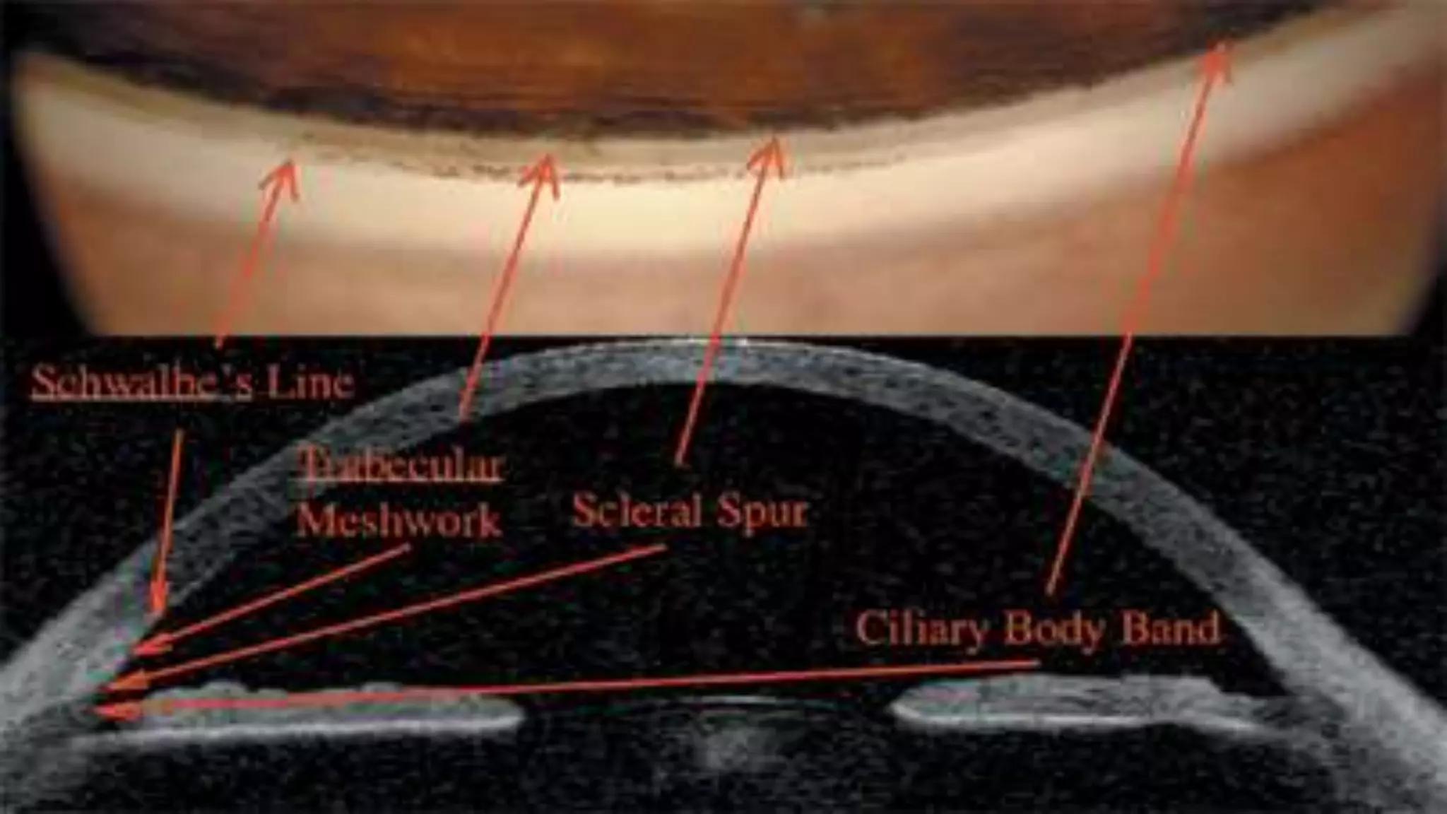 Production and flow of aqueous humor | PPTX