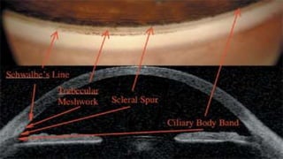 Production and flow of aqueous humor | PPTX