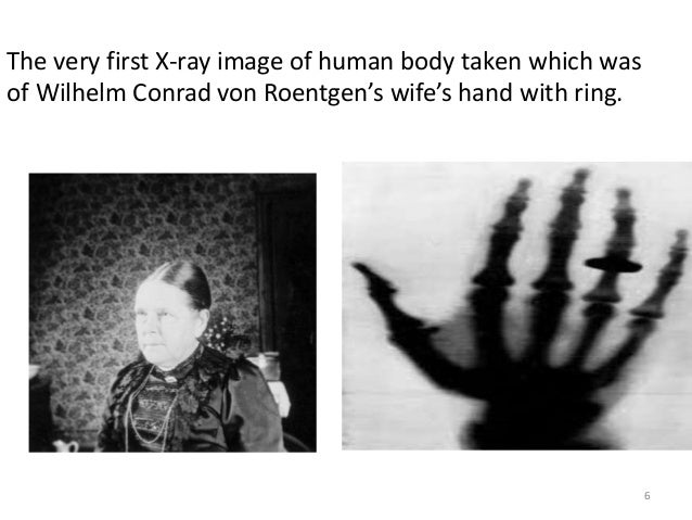 Production of x rays