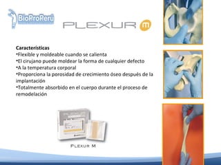 BioProPeru: Productos Osteobiologicos | PPT