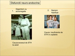 Proiect biologier | PPT