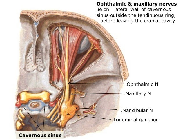 Trigeminal Impression Temporal Bone