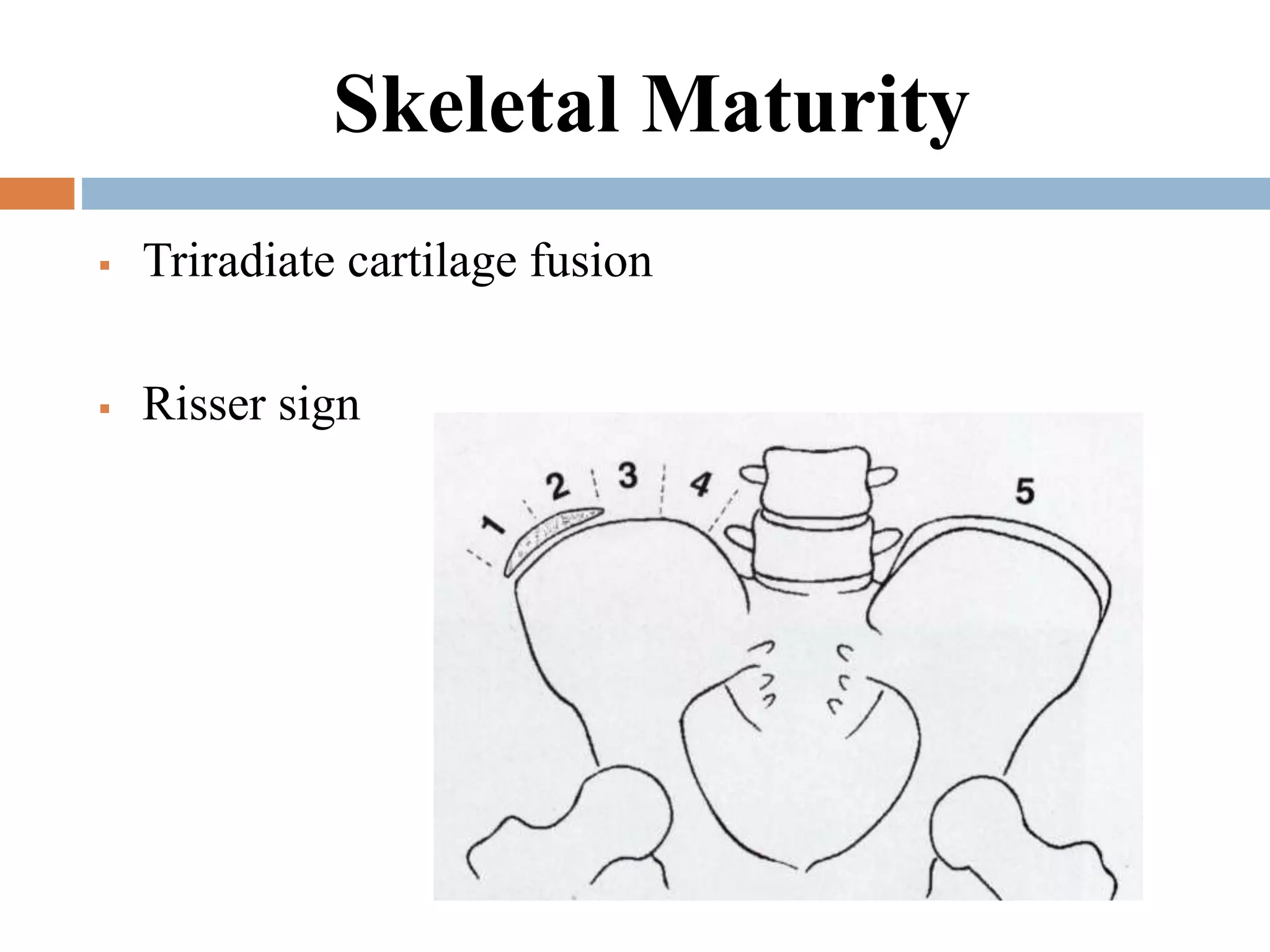 Prof. shah alam scoliosis 11 | PPTX