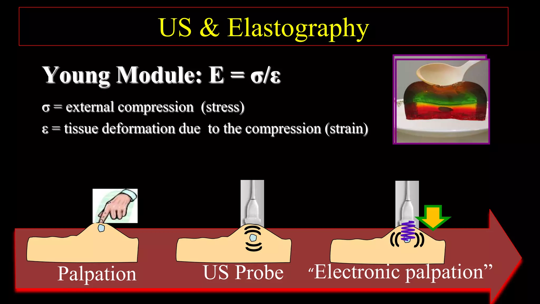 Elastosonografia | PPTX