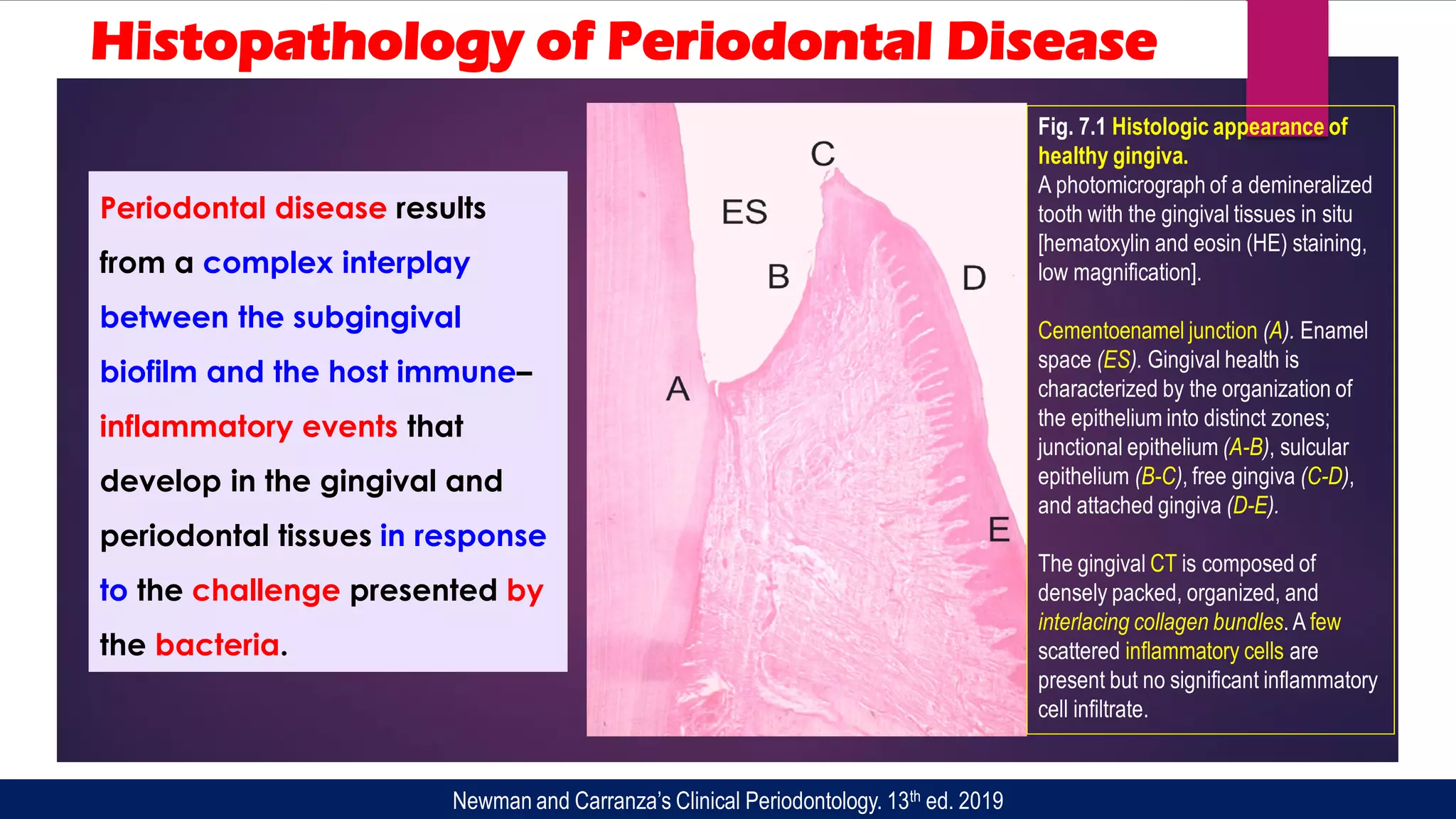 periodonta Disease pathogenesis | PDF