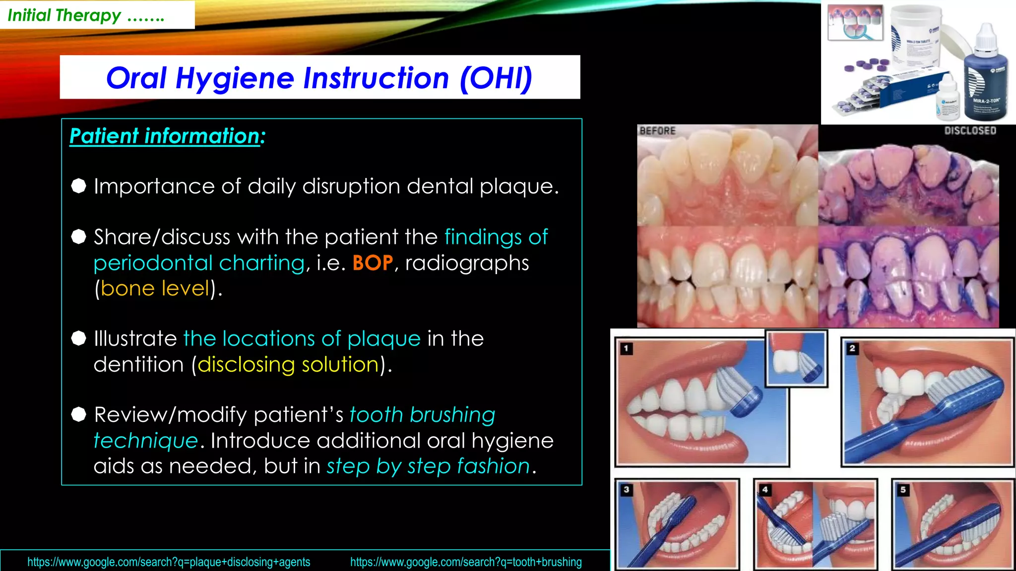 Periodontal Treatment Planning & Phase I Therapy | PDF