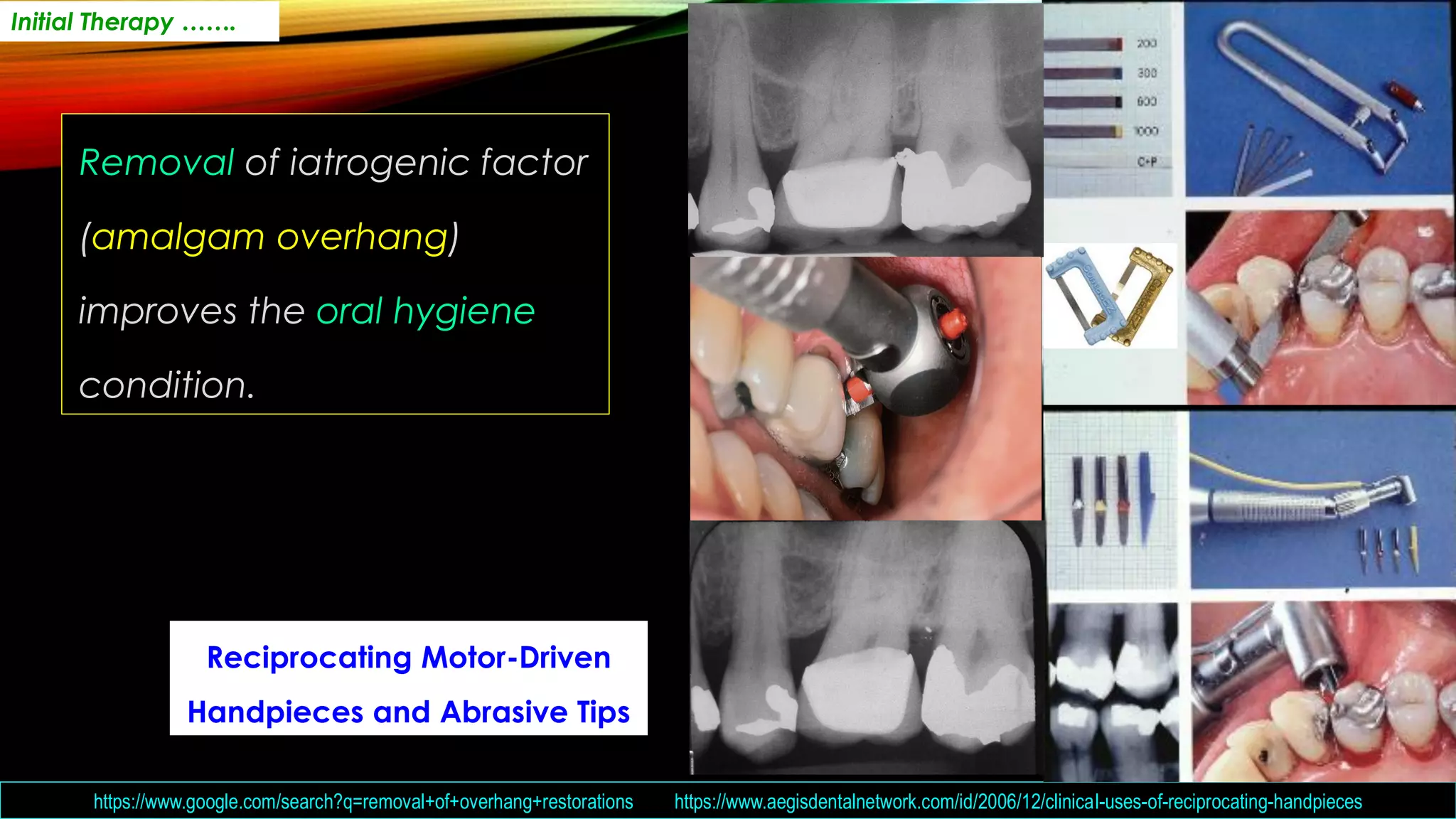 Periodontal Treatment Planning & Phase I Therapy | PDF
