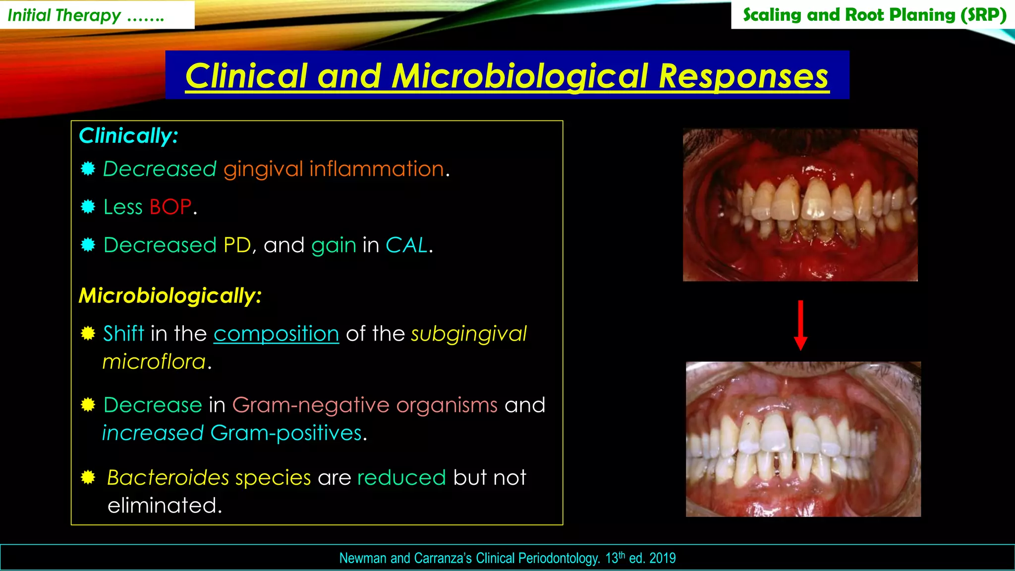 Periodontal Treatment Planning & Phase I Therapy | PDF