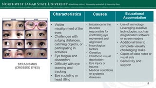 Prof.-Ed.-7-Learners-with-Visual-Disabilty.pptx | Eye and Vision ...