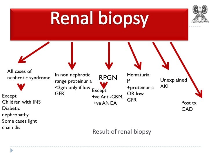 Prof. e. sarhan.work up of_proteinuric_patients