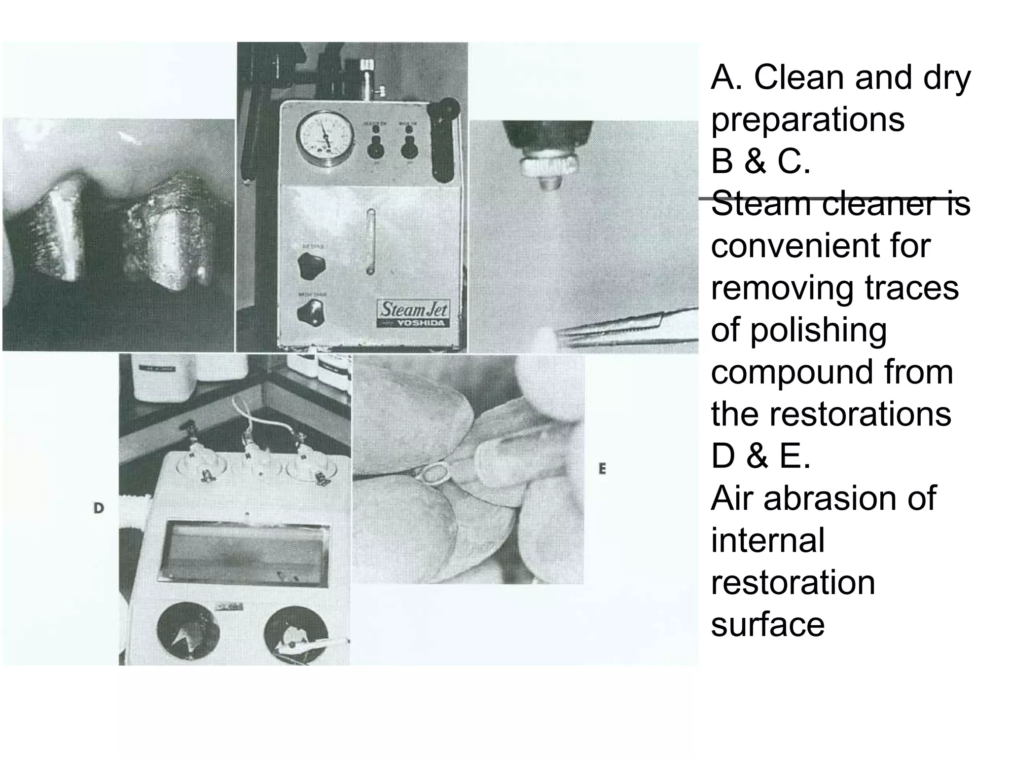 Luting agents and cementation | PPT