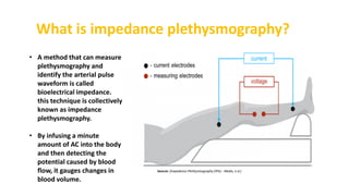 INVESTIGATING THE USE OF IMPEDANCE PLETHYSMOGRAPHY FOR DETECTING DECREASED BLOOD FLOW IN ...