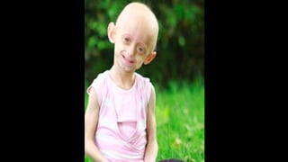 Profeti 4 al.pptx | Medical Health