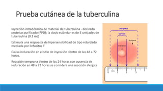 Profilaxis tuberculosis | PPTX