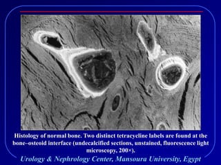 Renal Osteodystrophy Histology