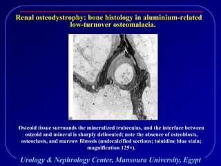 Renal Osteodystrophy Histology