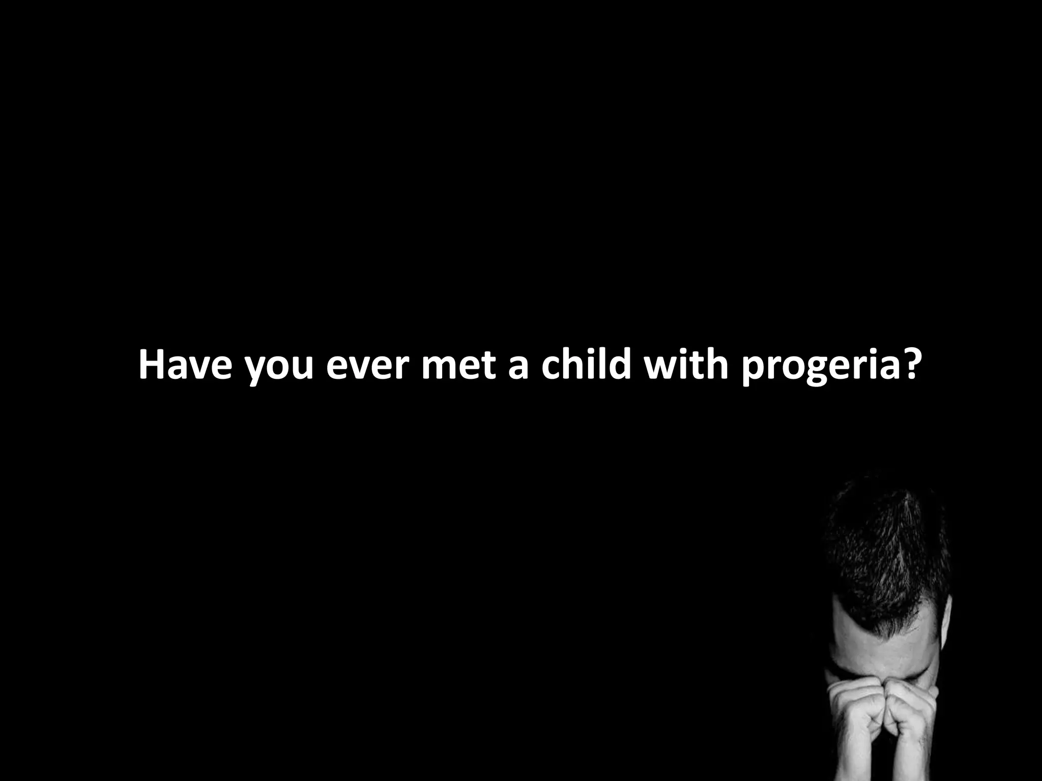 Progeria | PPTX