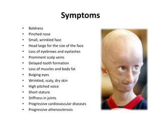 Progeria Adults