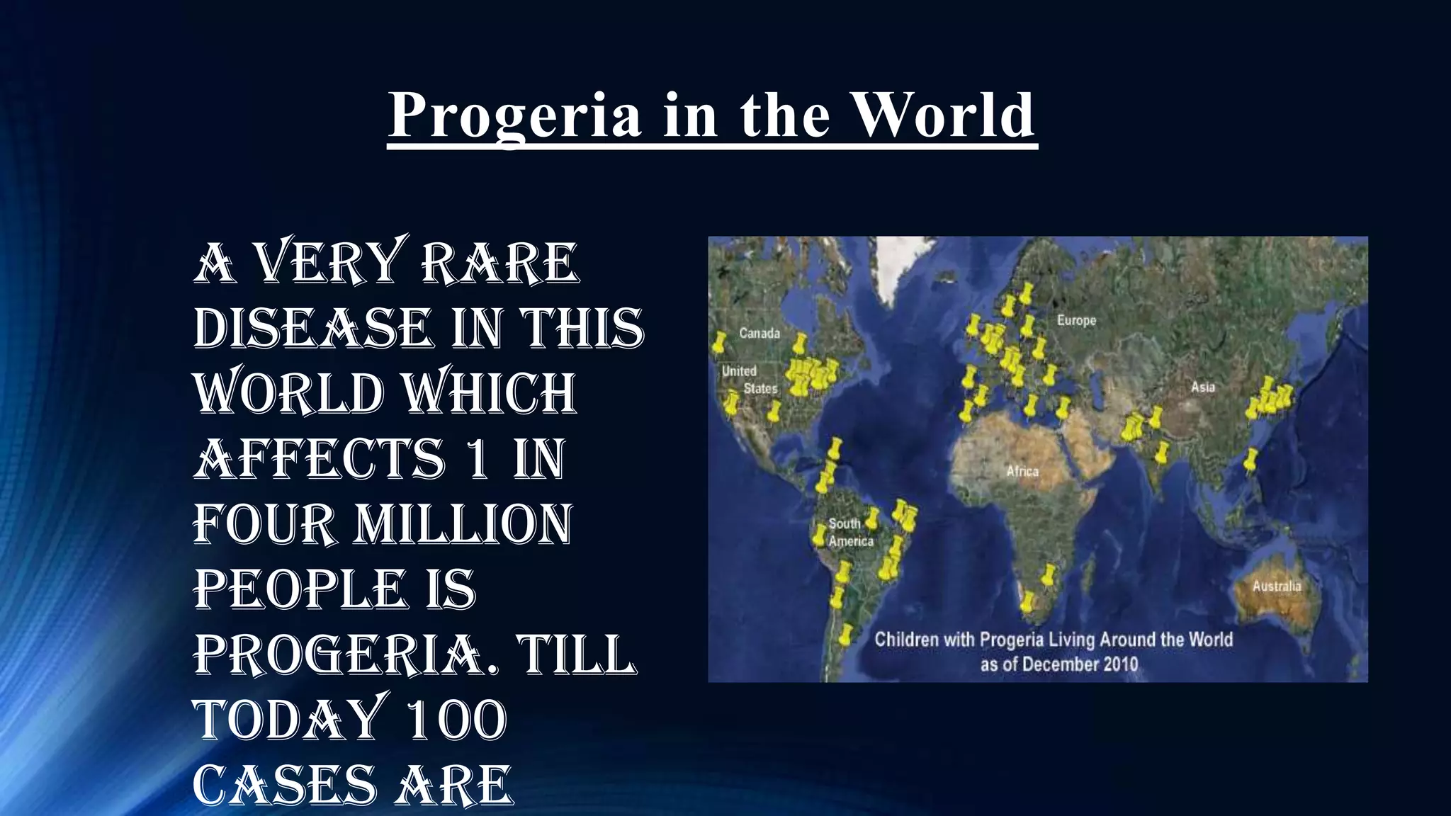 Progeria | PPTX
