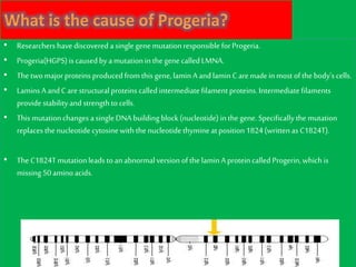 Progeria.2 | PPT