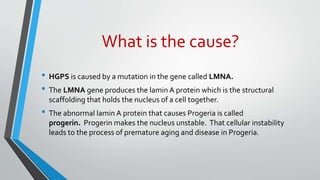 Progeria Syndrome | PPTX