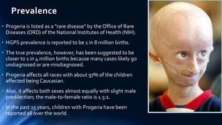 Progeria mostafa. | PPT