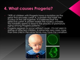 Progeria , by Lucia | PPSX