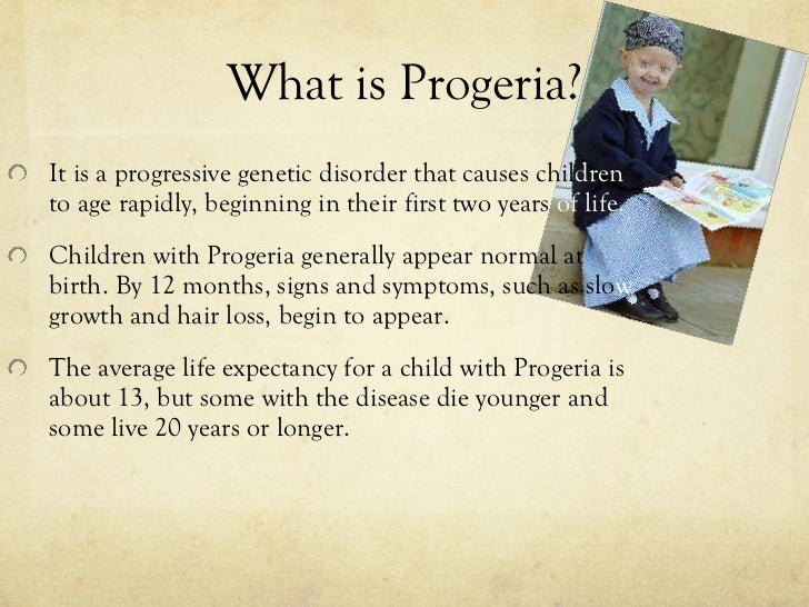 Progeria Life Expectancy Frontiers | It Is Time To Classify Biological