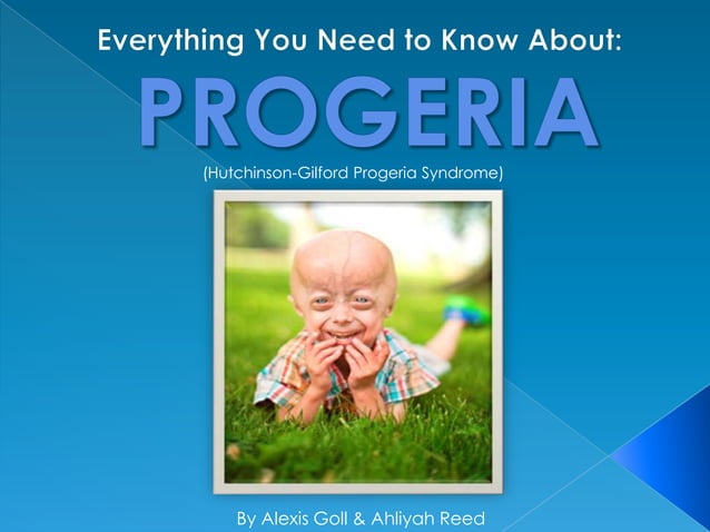 Everything you Need to Know About Progeria | PPTX | Genetics | Science
