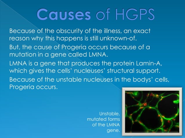 Everything you Need to Know About Progeria | PPTX | Genetics | Science