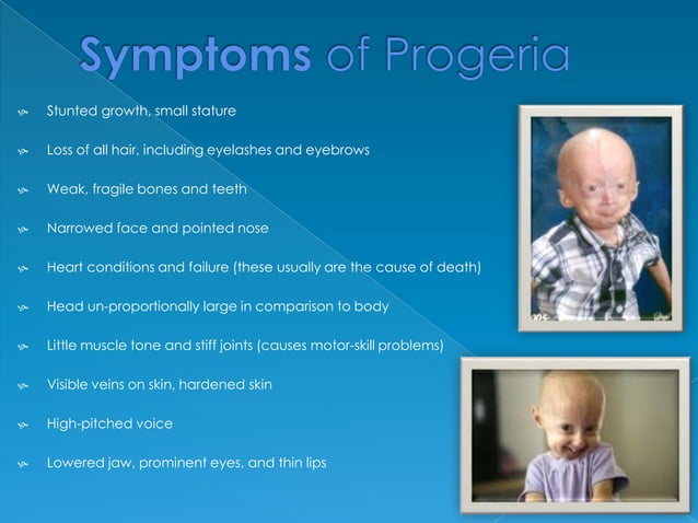 Everything you Need to Know About Progeria | PPTX | Genetics | Science
