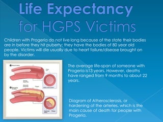 Everything you Need to Know About Progeria | PPTX