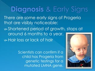 Everything you Need to Know About Progeria | PPT