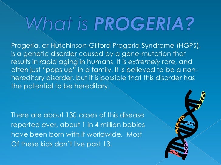 Everything you Need to Know About Progeria